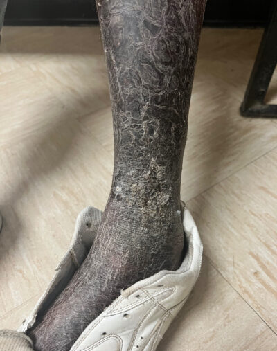 Investigation Reveals Widespread Medical Neglect in Mississippi Prisons